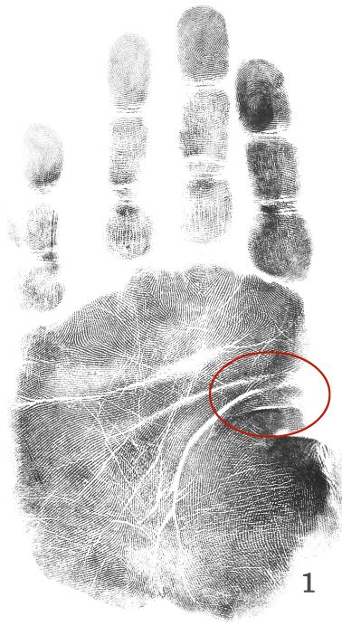 Biometric Markers of Autism: - עמירה הולצמן שמוטר